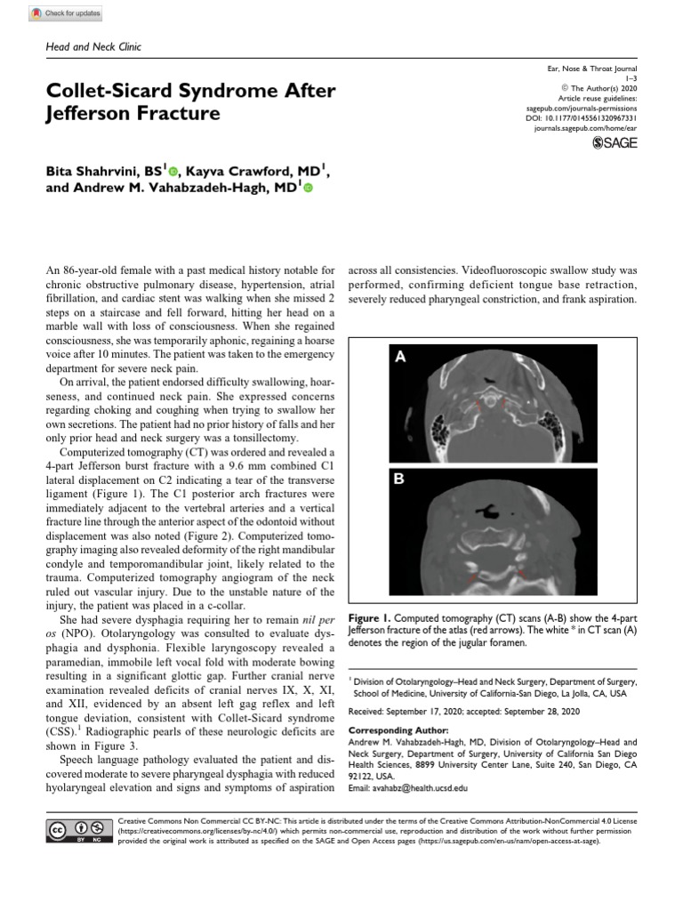 Collet-Sicard Syndrome Post-Jefferson Fracture | PDF | Spinal Cord ...