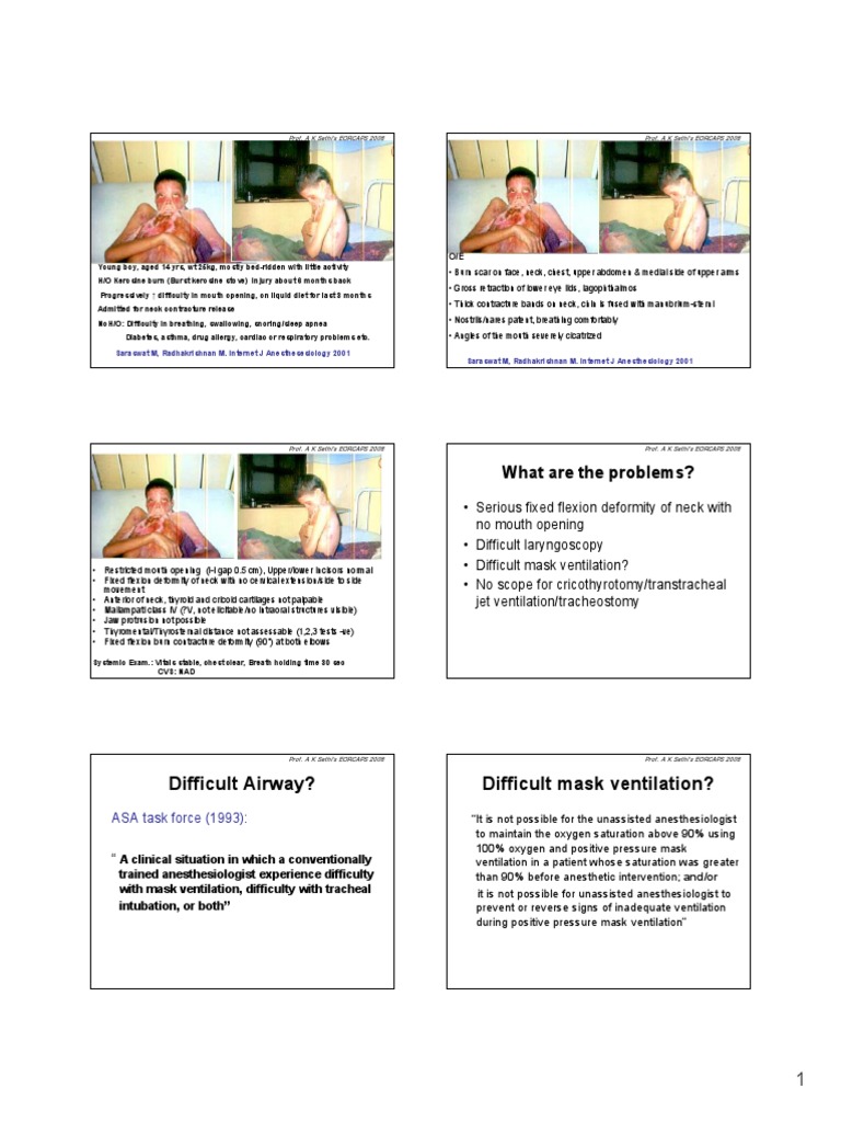 Difficult Airway? Difficult Mask Ventilation? | PDF | Anesthesia | Burn