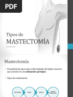 Cuadrantectomía: Definición y Tipos | PDF | Cáncer de mama | Cáncer