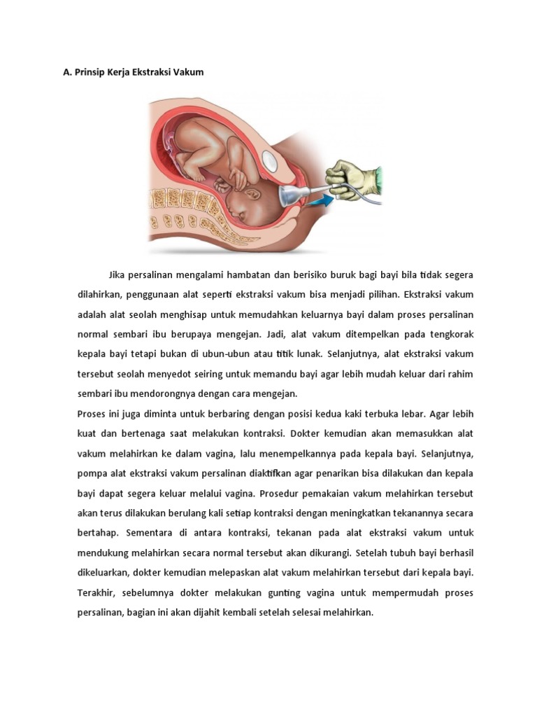 Prinsip Kerja Ekstraksi Vakum | PDF | Kesehatan Holistik