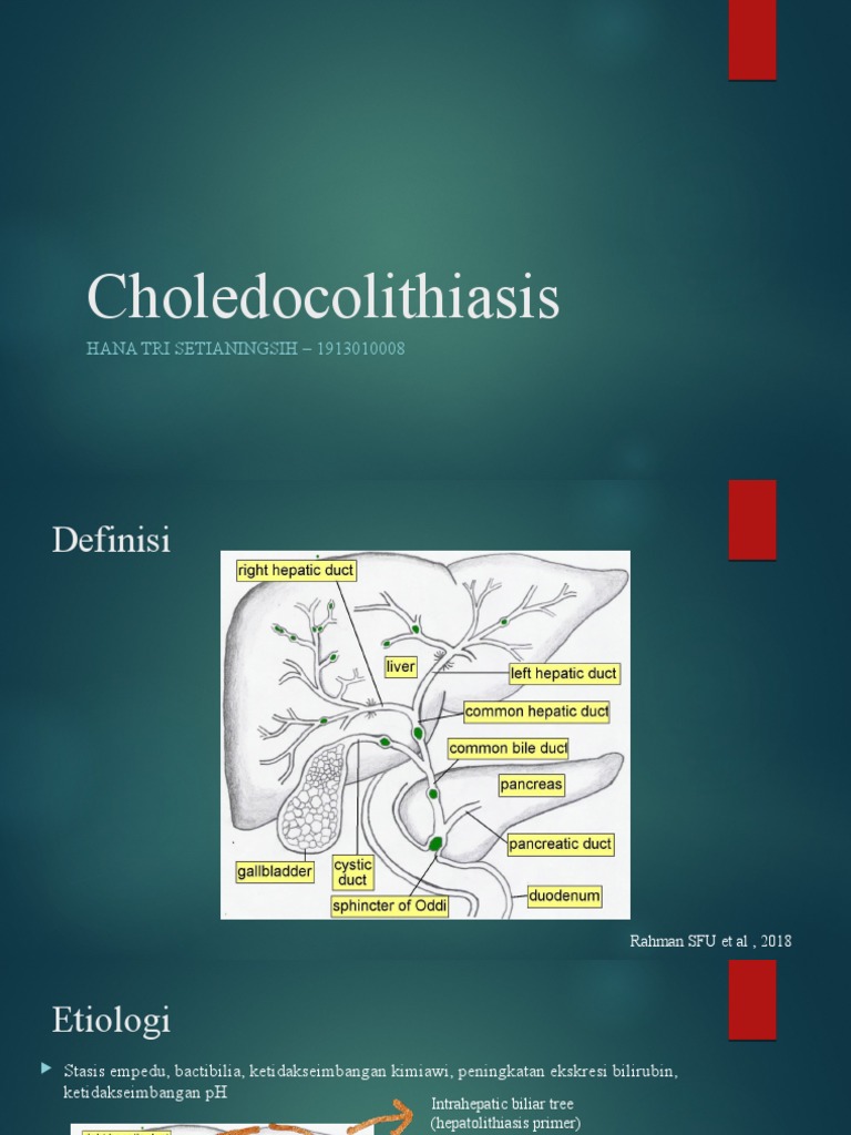 Panduan Lengkap Choledocolithiasis | PDF | Kesehatan Holistik
