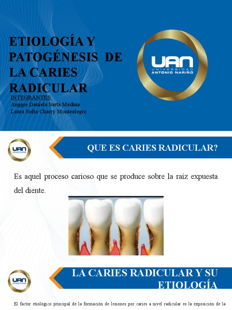 Caries Radicular | PDF | Odontología | Especialidades Medicas