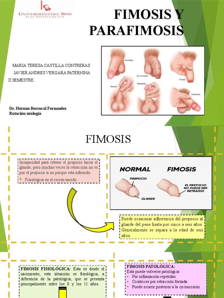Fimosis y Parafimosis | PDF | Mamíferos machos | Sistema Reproductor ...