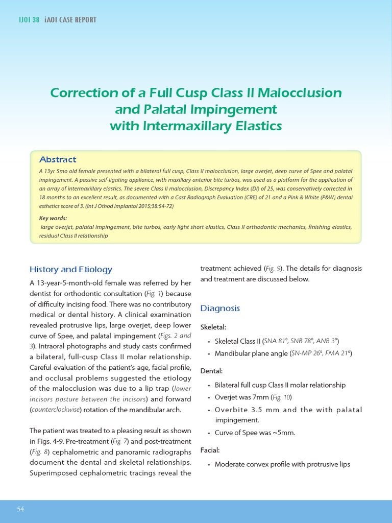 Correction of A Full Cusp Class II Malocclusion and Palatal Impingement ...