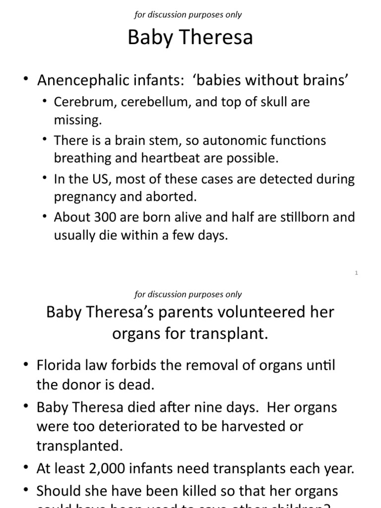 Baby Theresa: - Anencephalic Infants: Babies Without Brains' | PDF