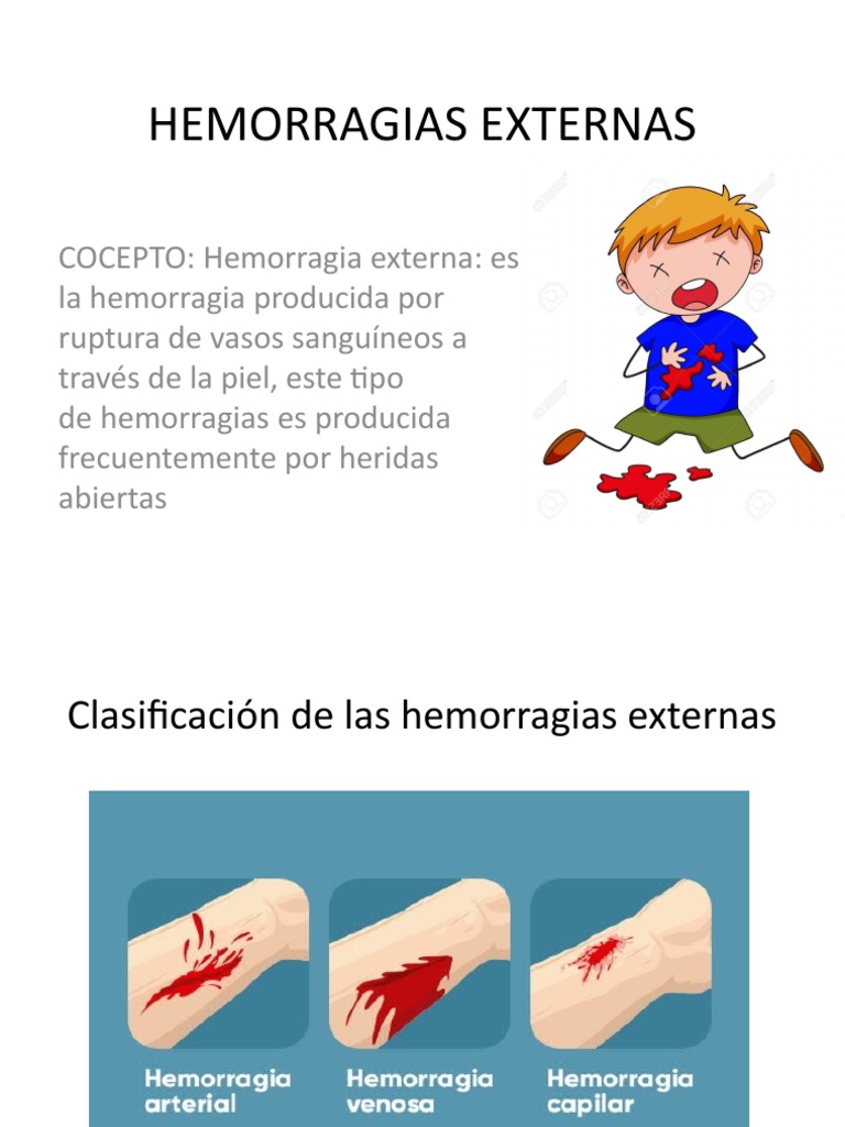 Hemorragias Externas | PDF