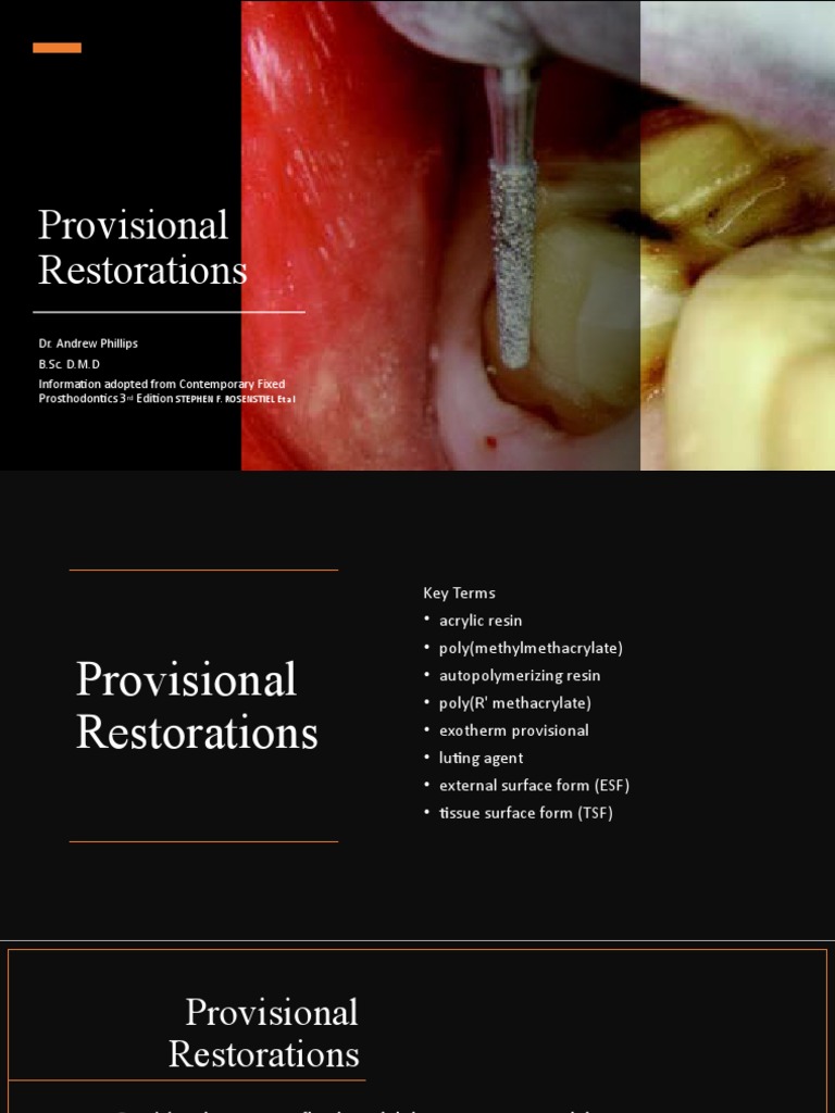 Provisional Restorations in Dentistry | PDF | Dentures | Periodontology