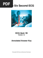 Pac PJC PVC | PDF | Cardiac Electrophysiology | Cardiac Arrhythmia