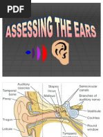 Stenger Test Guide | PDF | Hearing Loss | Ear