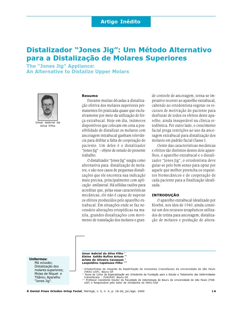 Distalizador Jones Jig Um Método Alternativo para A Distalização de ...