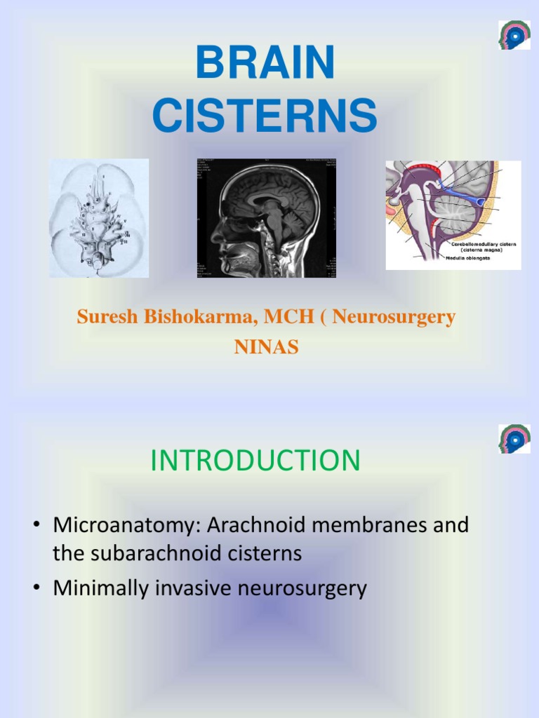 Brain Cisterns: Anatomy and Clinical Implications | PDF | Common ...