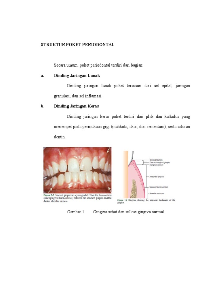 Poket Periodontal dan Pemeriksaannya | PDF | Kesehatan Holistik | Sains & Matematika