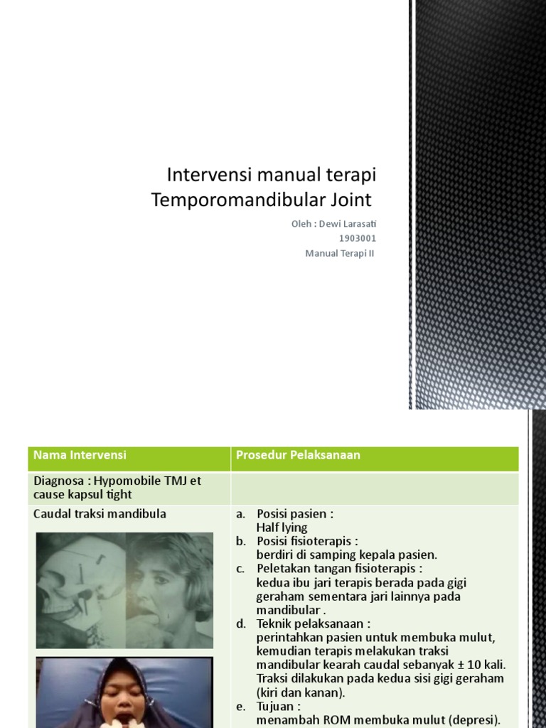Intervensi Manual Terapi Temporomandibular Joint | PDF