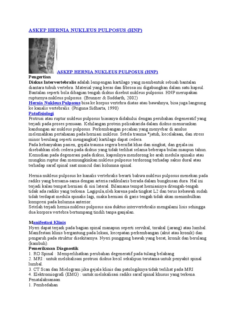 Askep Hernia Nukleus Pulposus | PDF