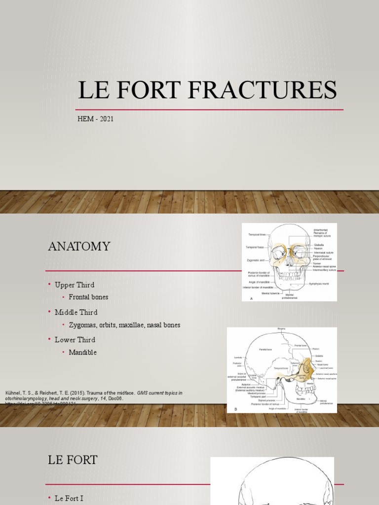 Le Fort Fractures | PDF | Face | Anatomy
