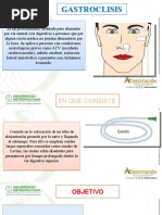 CISTOCLISIS | PDF | Vejiga urinaria | Orina