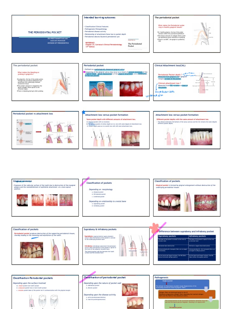 Understanding Periodontal Pockets | PDF | Periodontology | Dentistry