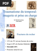 Fracture du rocher : enjeux cliniques | PDF | vertige | Traumatisme crânien