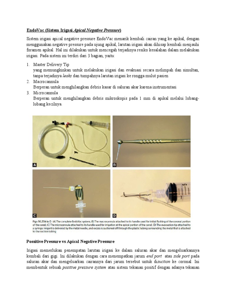 Endo Vac | PDF