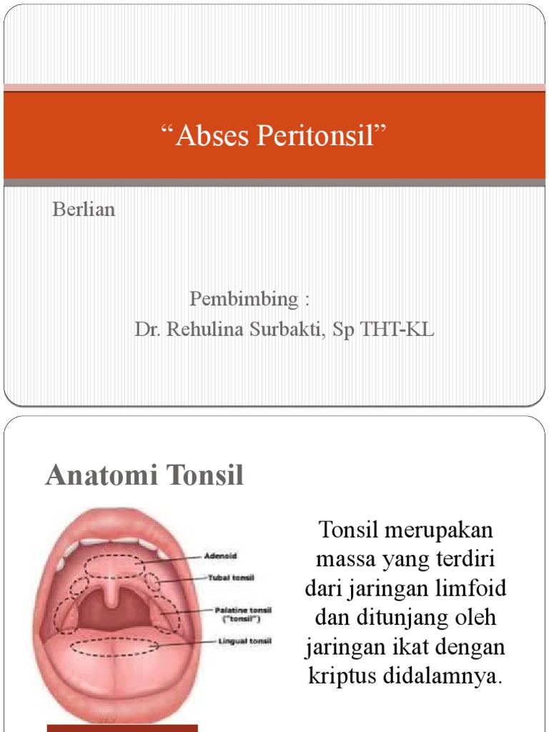 Abses Peritonsil | PDF