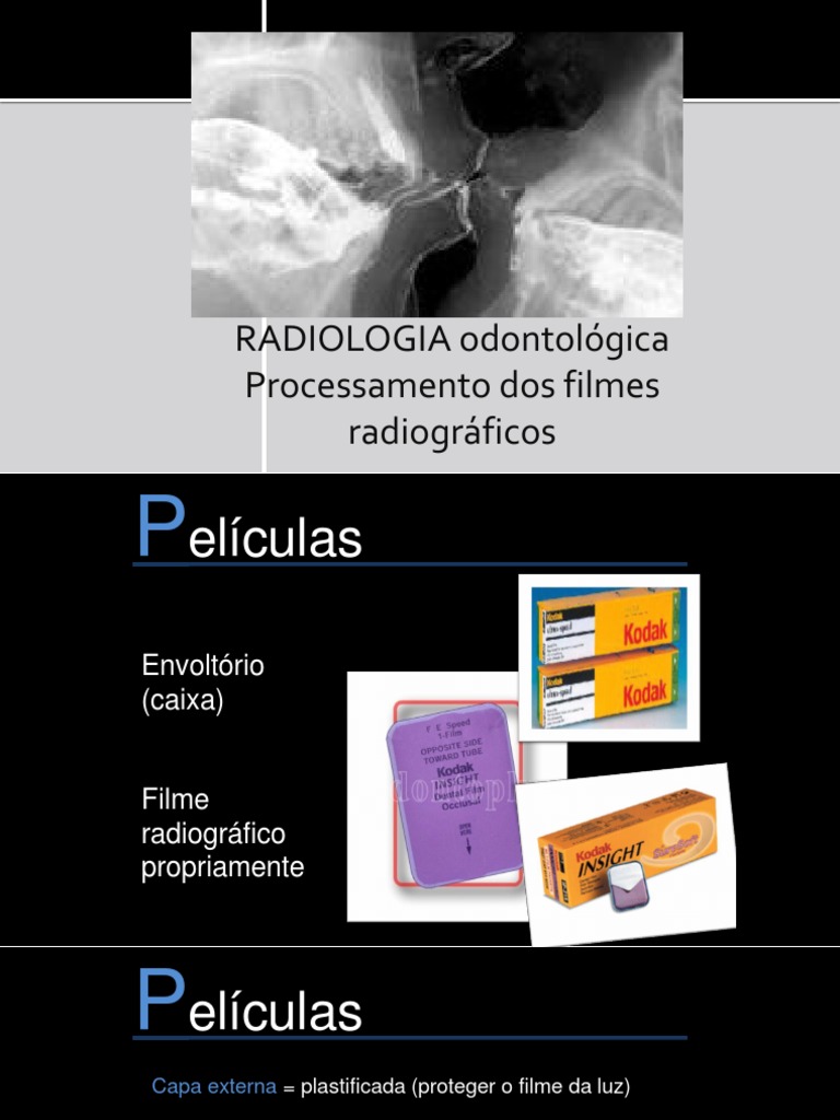 Aula Processamento Radiográfico | PDF | Radiologia | Química