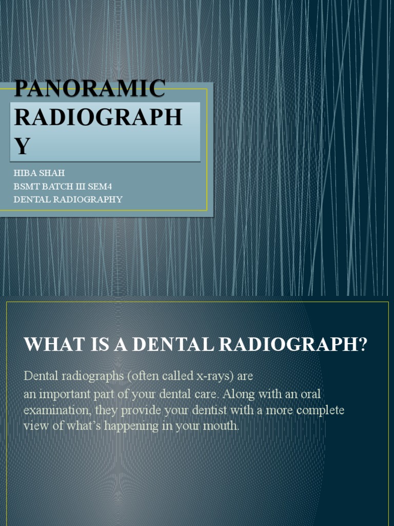 Panoramic Radiograph Y Panoramic Radiograph Y: Hiba Shah BSMT Batch Iii ...
