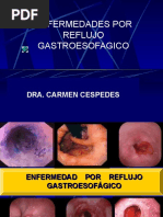 Clasificación de Savary Miller y Los Ángeles | PDF | La enfermedad por ...