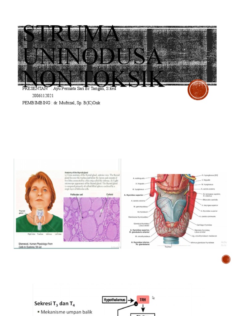 STRUMA UNINODUSA Non Toksik Baca DR Muf | PDF | Causes Of Death | Thyroid