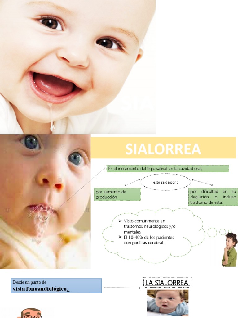 SIALORREA | PDF