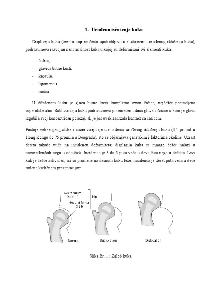 Urodjeno Iscasenje | PDF