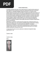 Tecnicas Apico Coronal | PDF | Ramas de Odontología