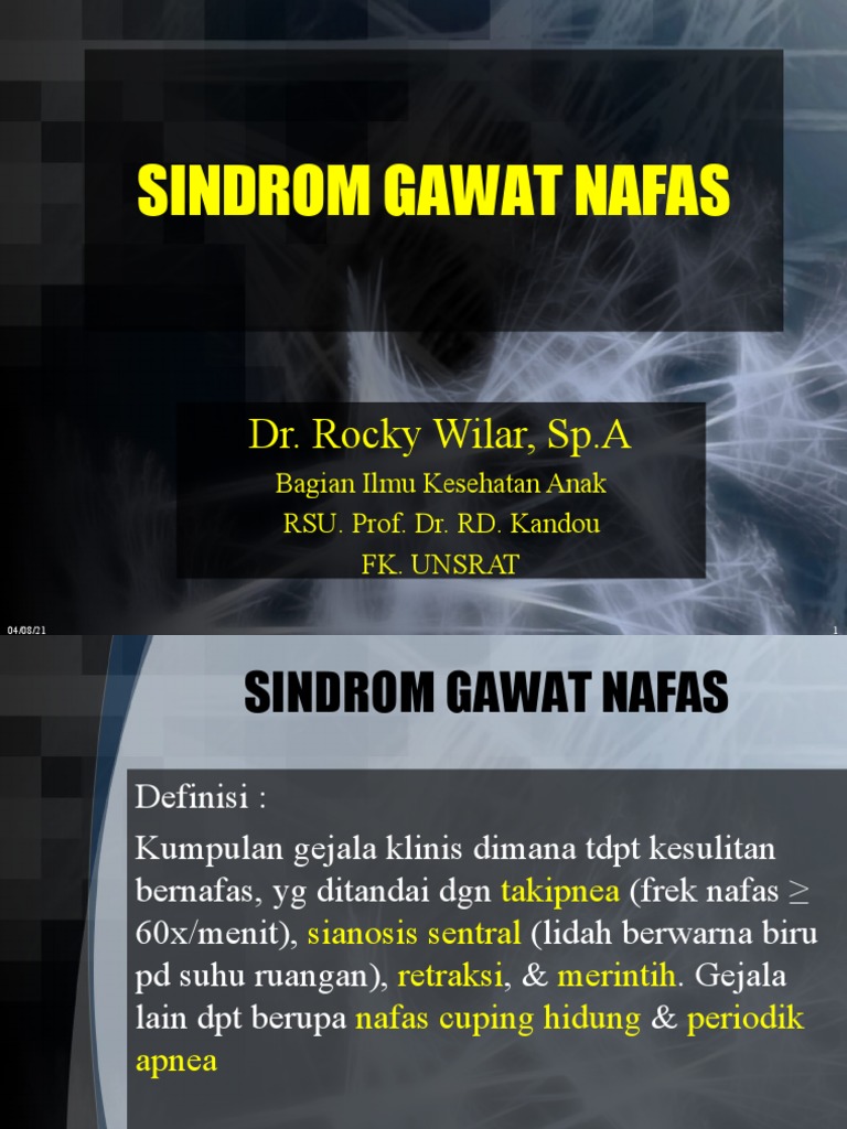 Sindroma Gawat Napas | PDF
