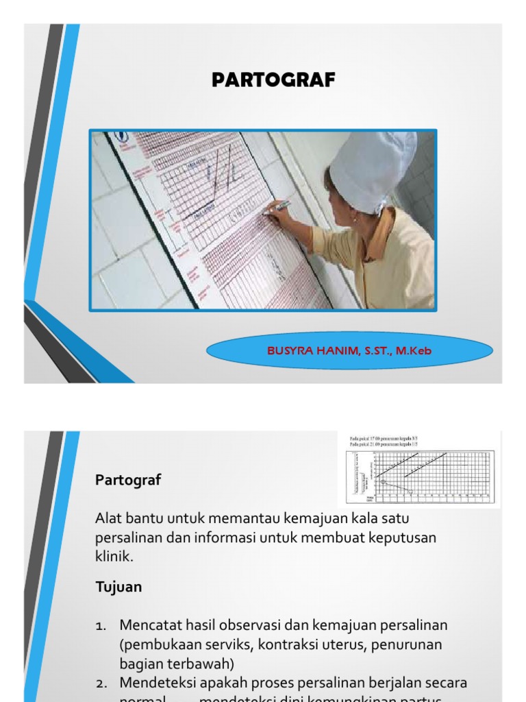 PARTOGRAF | PDF