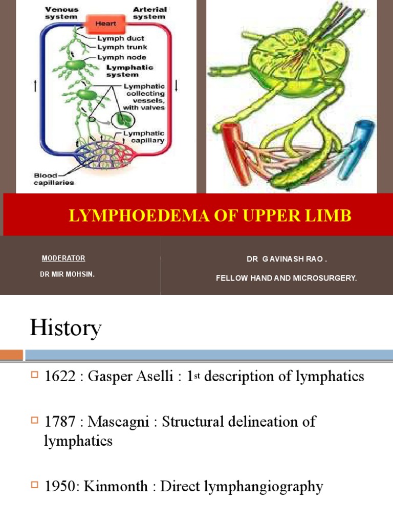 Lymphoedema of Upper Limb: DR G Avinash Rao - Fellow Hand and ...