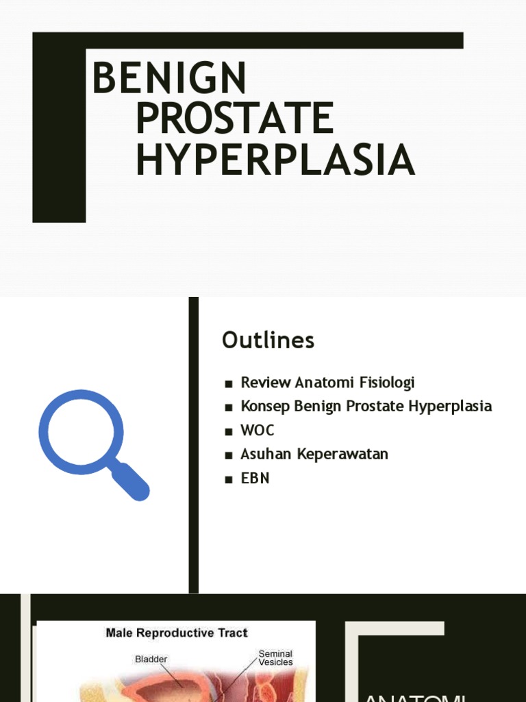 Benign Prostate Hyperplasia | PDF