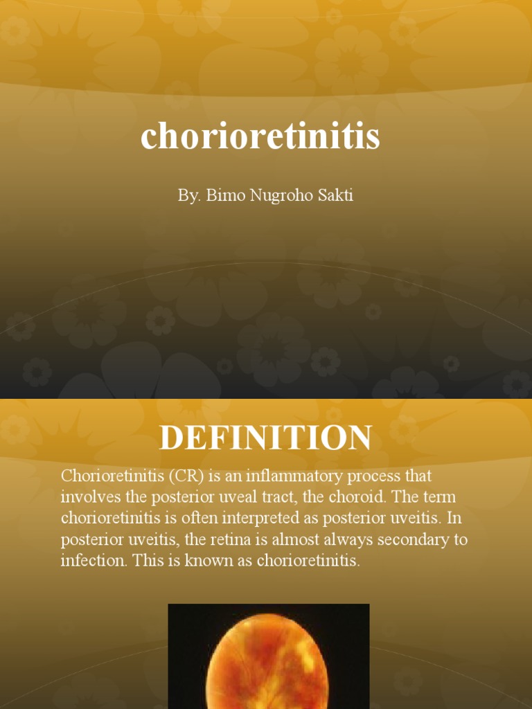 Chorioretinitis Overview and Treatment | PDF | Retina | Inflammation