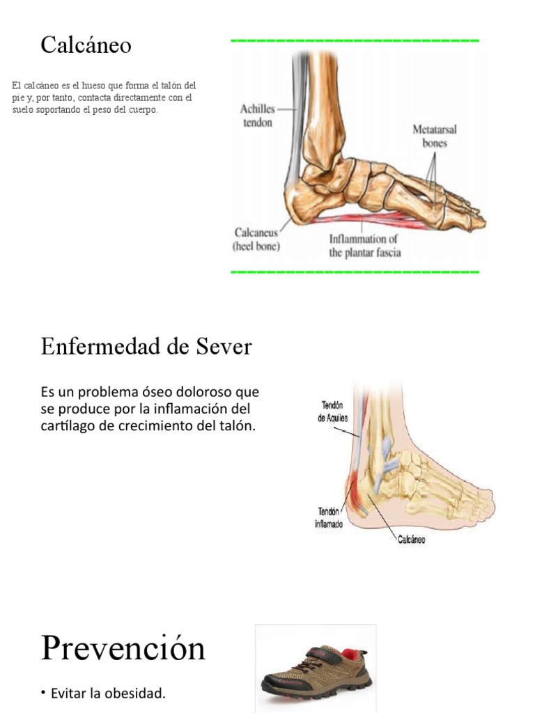 Calcáneo | PDF