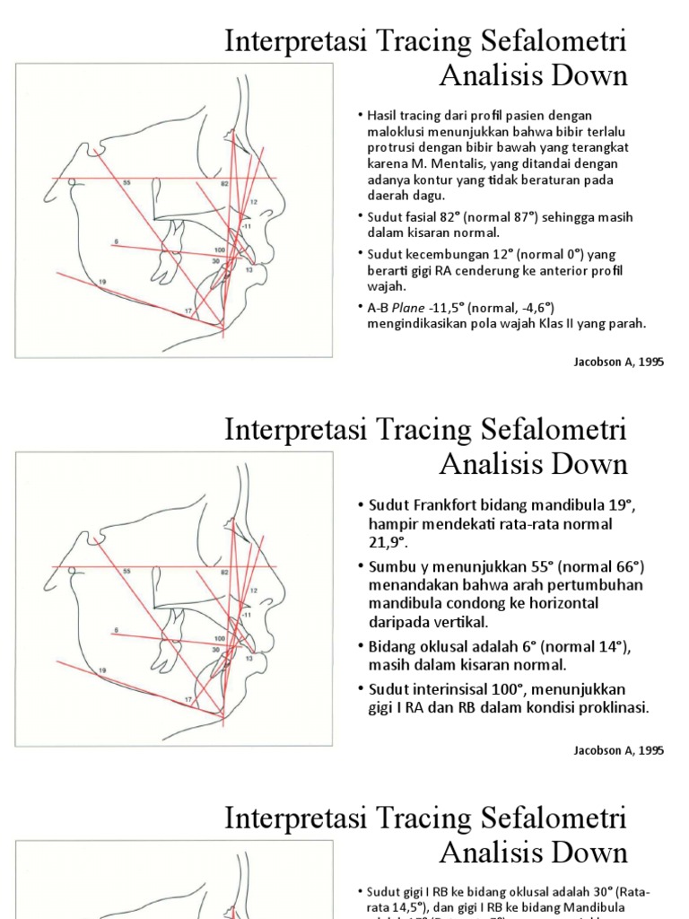 Interpretasi Tracing Sefalometri | PDF