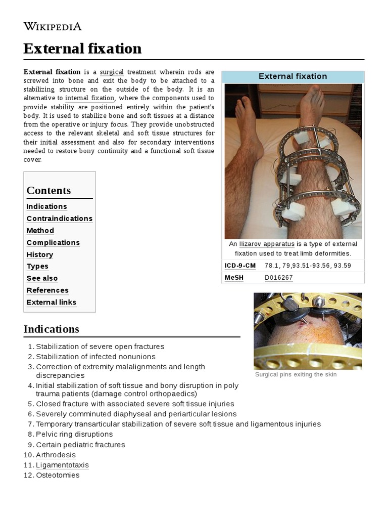 External Fixation | PDF | Surgical Specialties | Musculoskeletal System