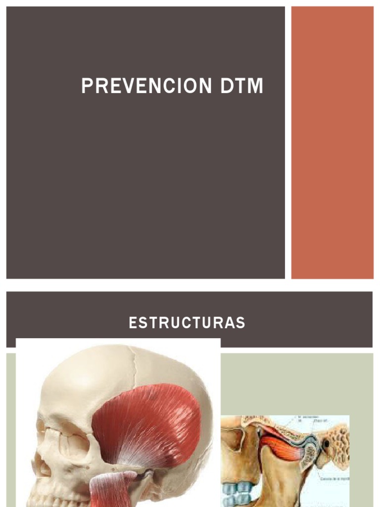 Prevencion DTM | PDF