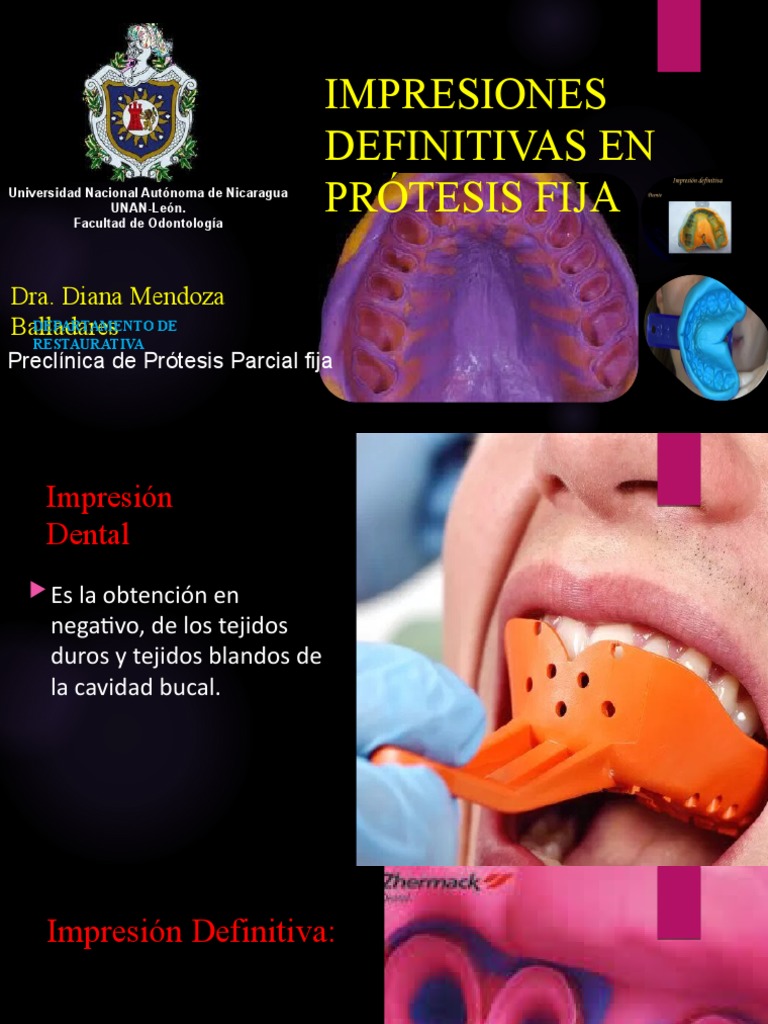 Impresiones Definitivas en Prótesis Fija | PDF | Silicona | Dentadura ...