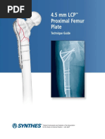 AO Plating Basics (Brief) | PDF | Stress (Mechanics) | Bending