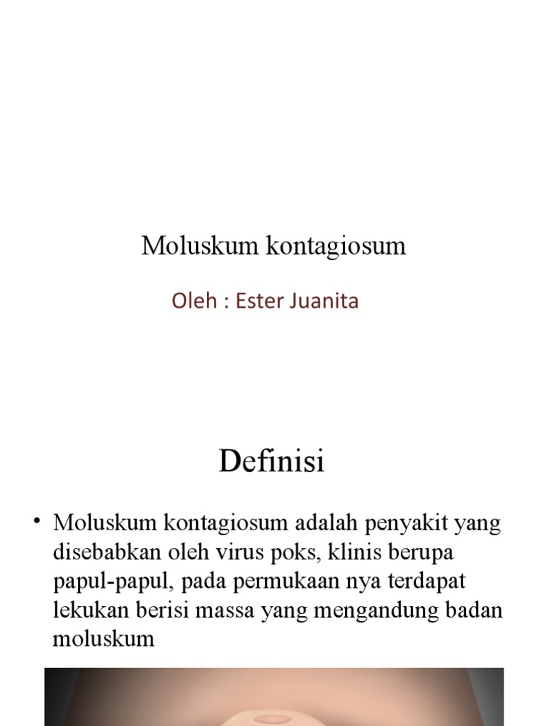 Ester Presentasi Moluskum Kontagiosum | PDF