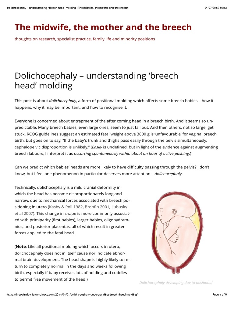 Dolichocephaly - Understanding Breech Head' Molding - The Midwife, The ...