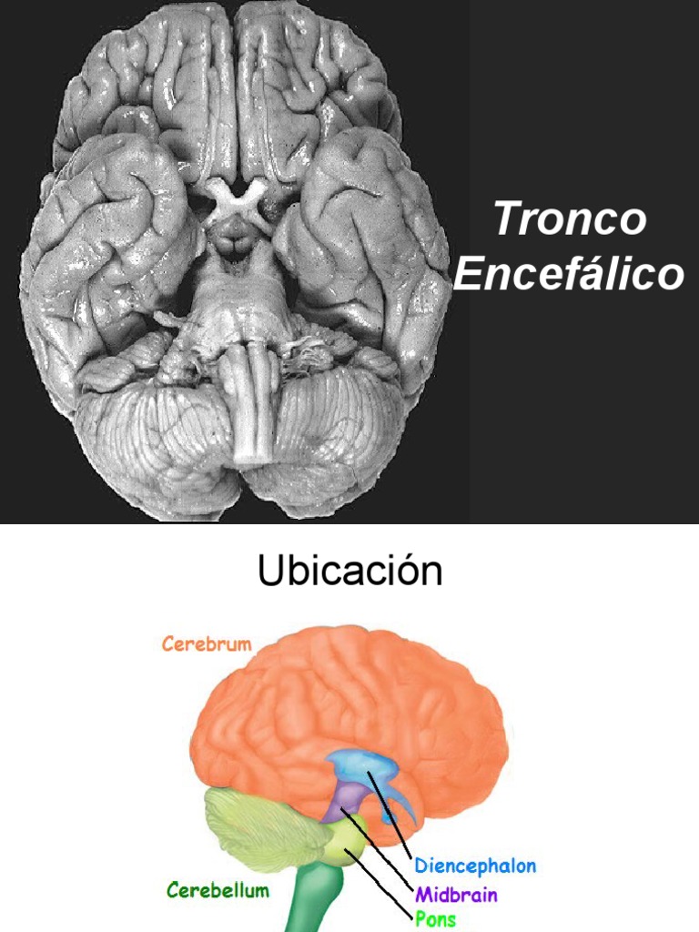Anatomiadotroncocerebral