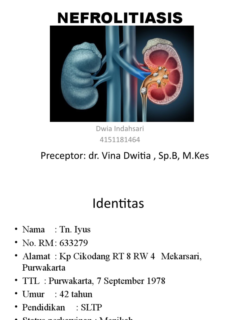Mini Cex Nefrolithiasis | PDF