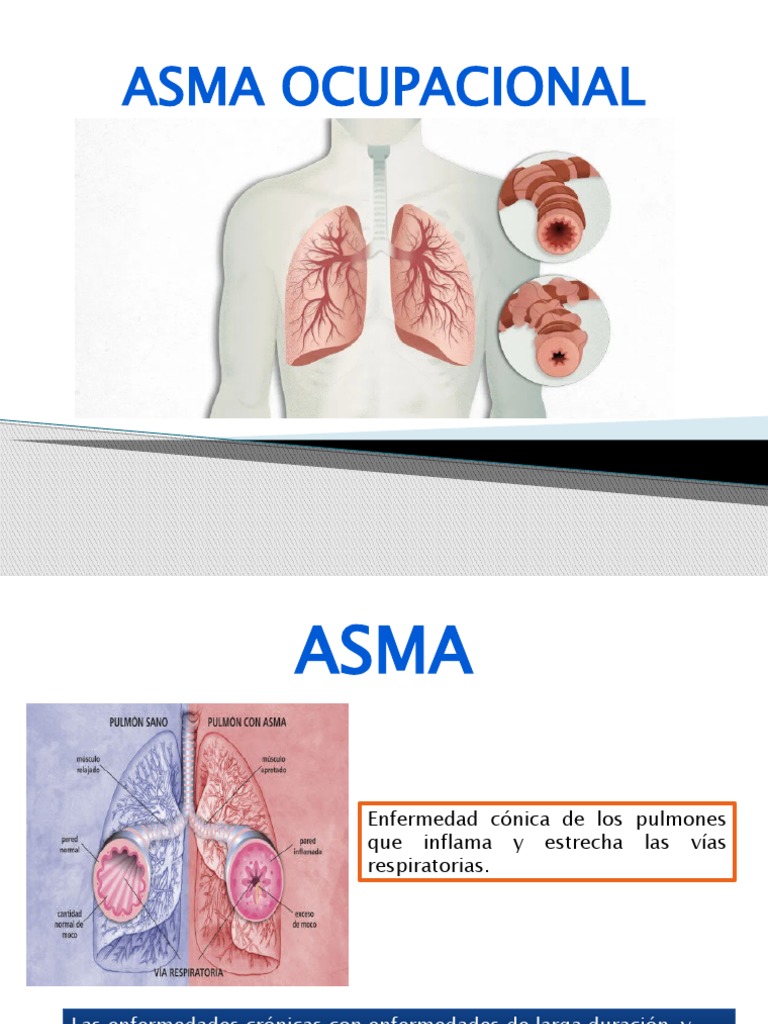 Asma Ocupacional | PDF | Asma | Tos