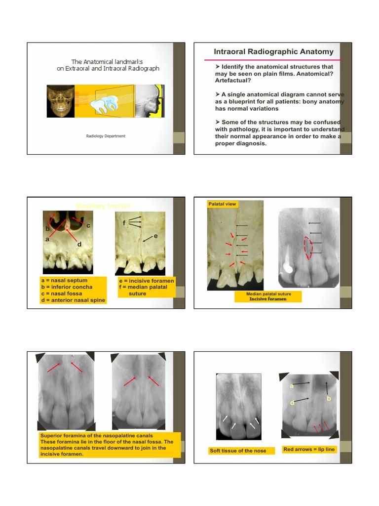 Anatomical Landmark PPT. TGL 25 | PDF | Human Nose | Human Anatomy