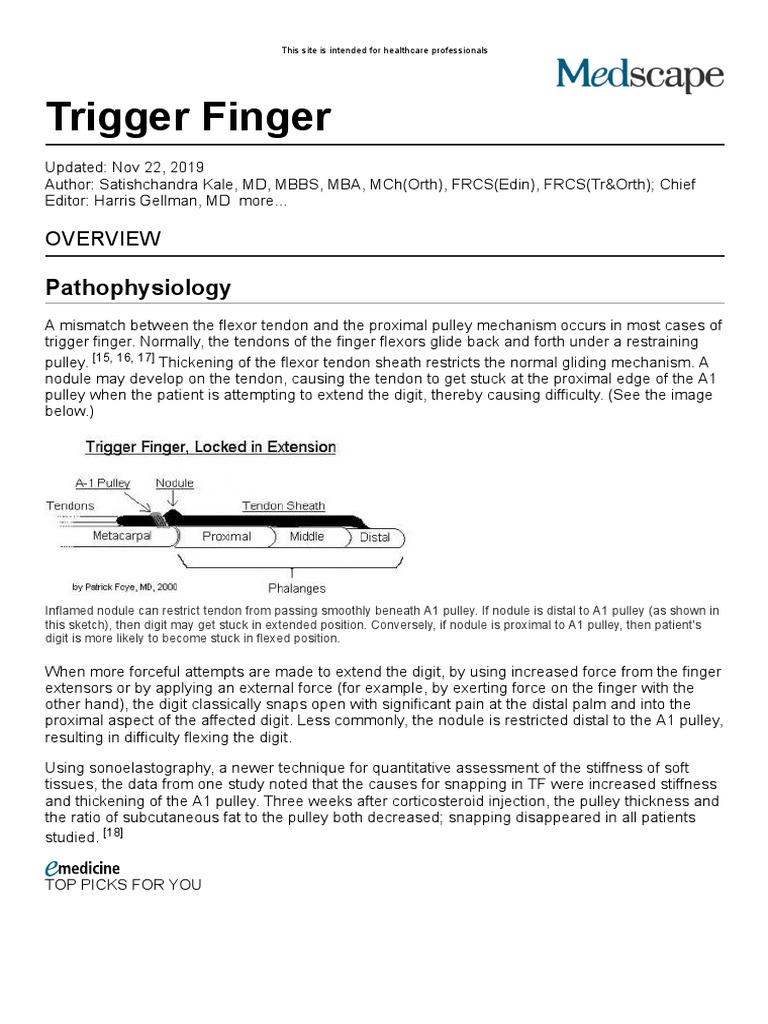 Trigger Finger - Practice Essentials, Background, Anatomy | PDF