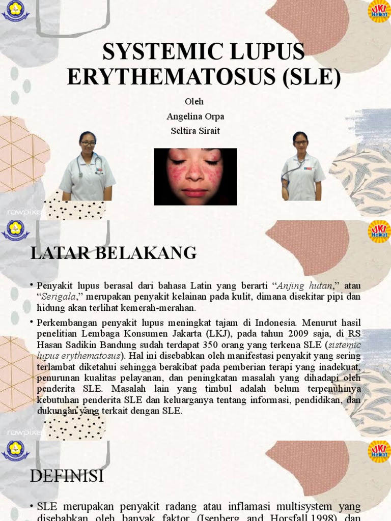 Systemic Lupus Erythematosus (Sle) | PDF